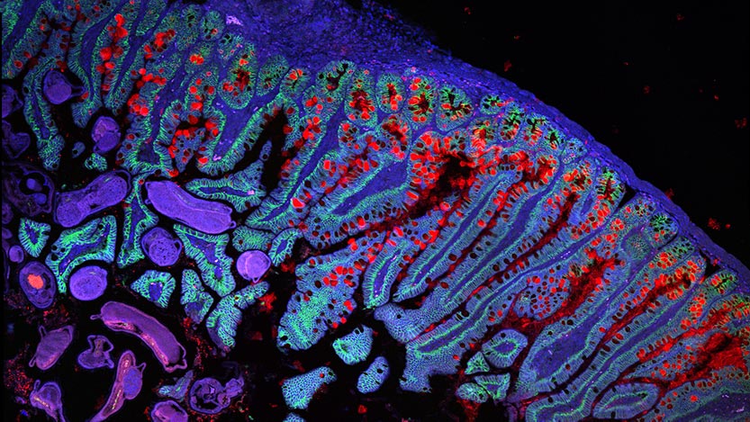 UChicago receives grants to map every type of gut cell - UChicago Medicine