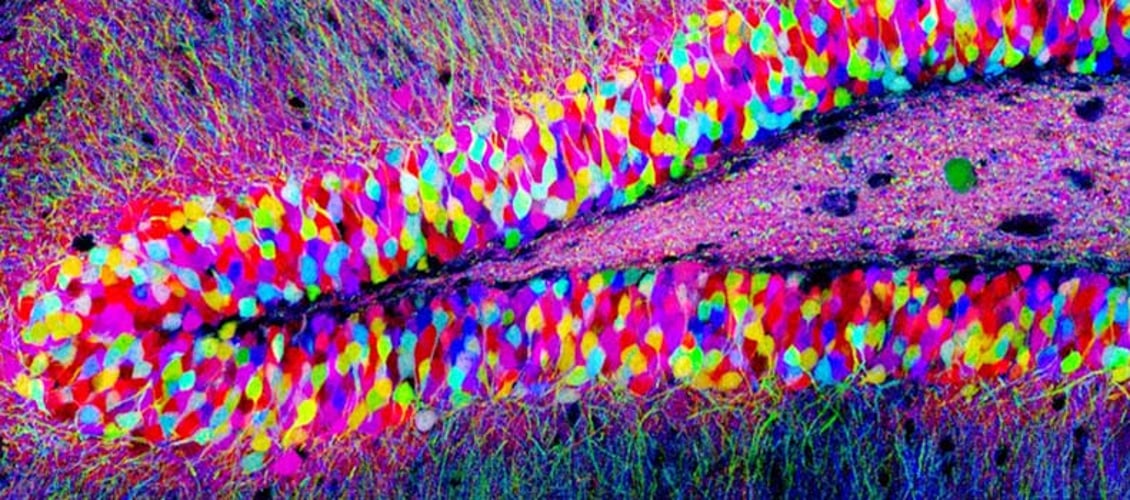 Brainbow Hippocampus