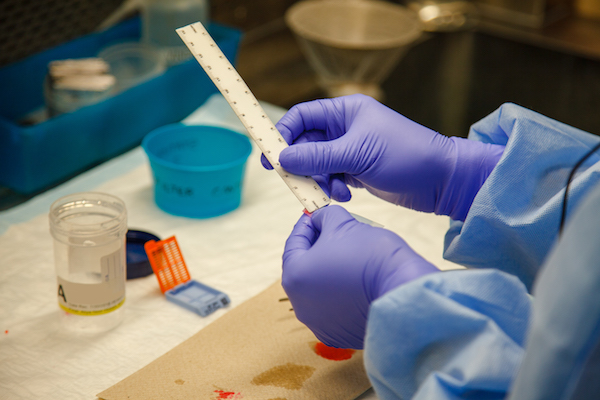 How pathologists diagnose disease and find treatments - UChicago Medicine