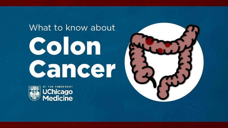 Colon Cancer Stool Shape