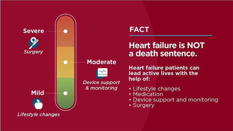 Congestive Heart Failure Symptoms, Signs and Treatments - UChicago Medicine