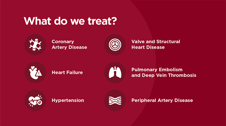 Interventional Cardiology - UChicago Medicine