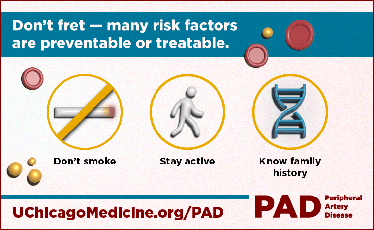 Peripheral Artery Disease: Symptoms, Causes & Treatments - UChicago ...