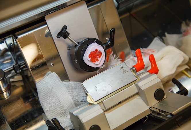 How pathologists diagnose disease and find treatments - UChicago Medicine