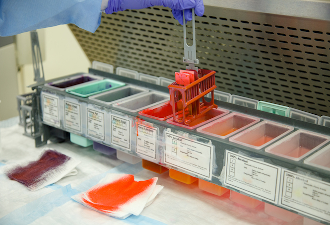 How pathologists diagnose disease and find treatments - UChicago Medicine