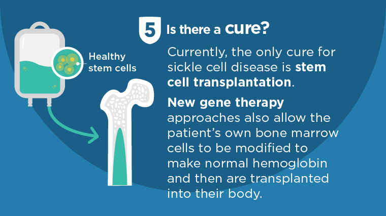 Sickle Cell Anemia Bone Marrow Transplant